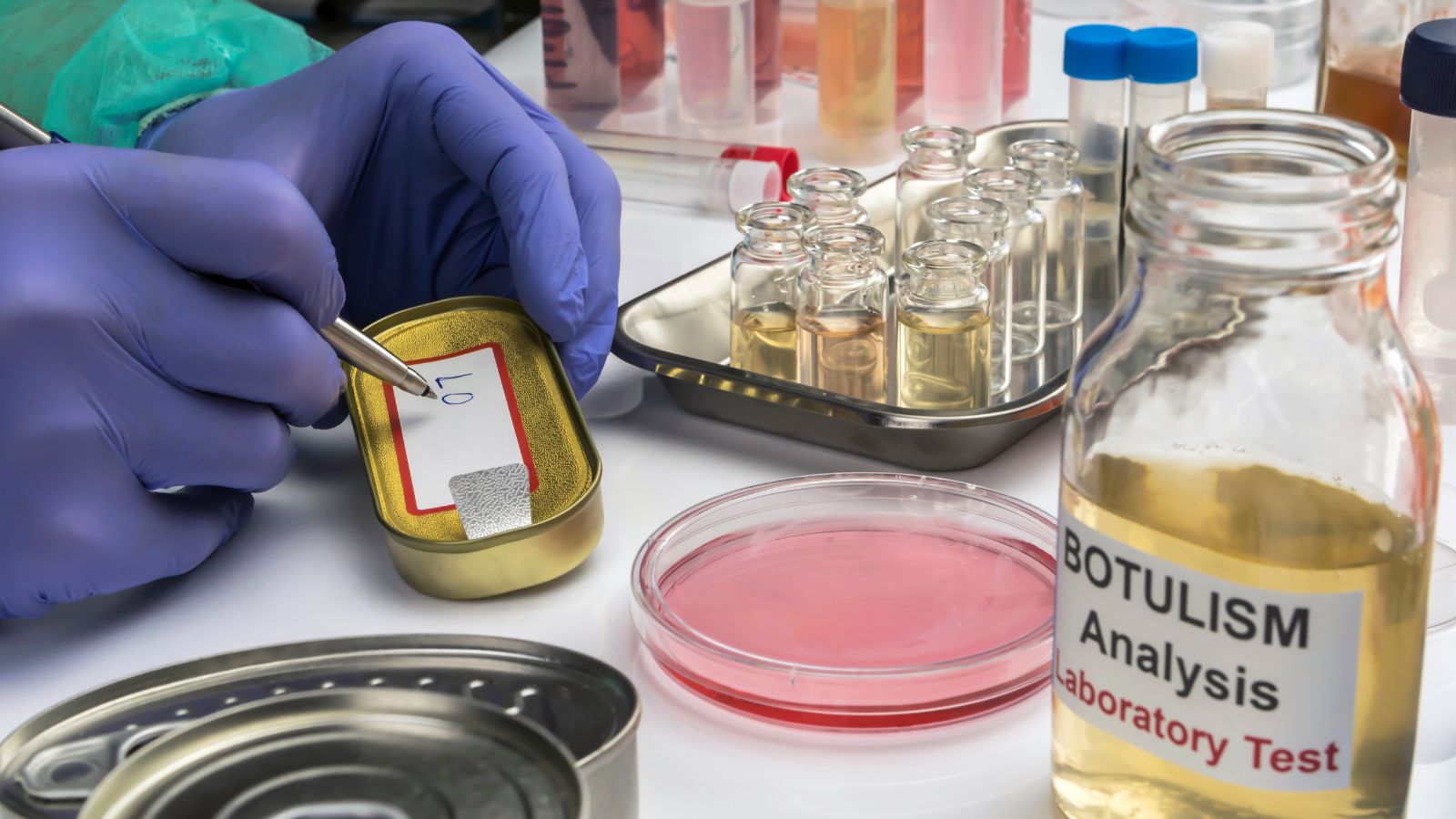 Botulizam: Kako se manifestuje i zašto nastaje tzv. otrov kobasica ...